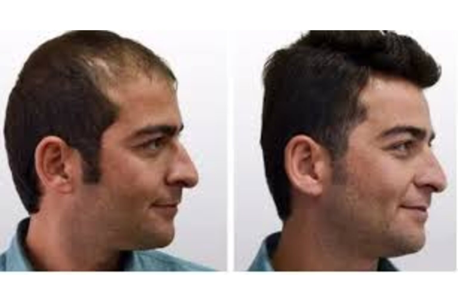 Home - Natural Hair Fixing Centre